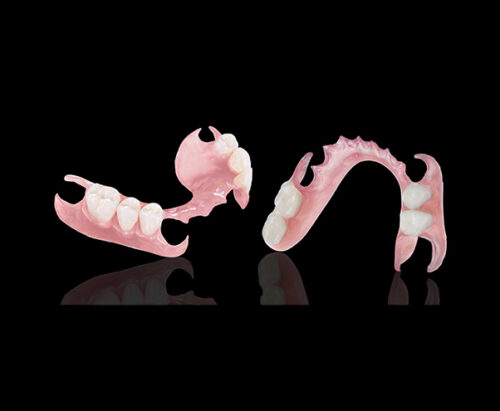 Valplast Dentures | Preferred Dental Laboratory