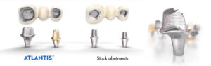 Atlantis Implant Abutments | Preferred Dental Laboratory