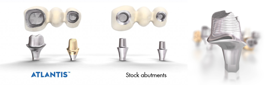 Atlantis Implant Abutments | Preferred Dental Laboratory