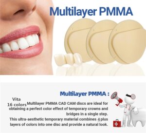 PMMA Dental Restorations | Preferred Dental Laboratory