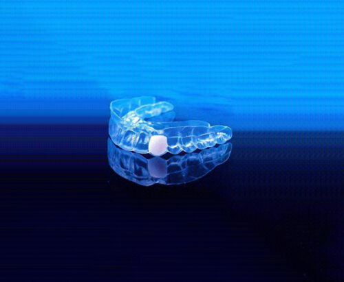 Essix Appliance | Preferred Dental Laboratory