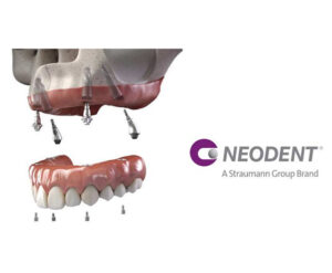 Neodent® Dental Implants | Preferred Dental Laboratory
